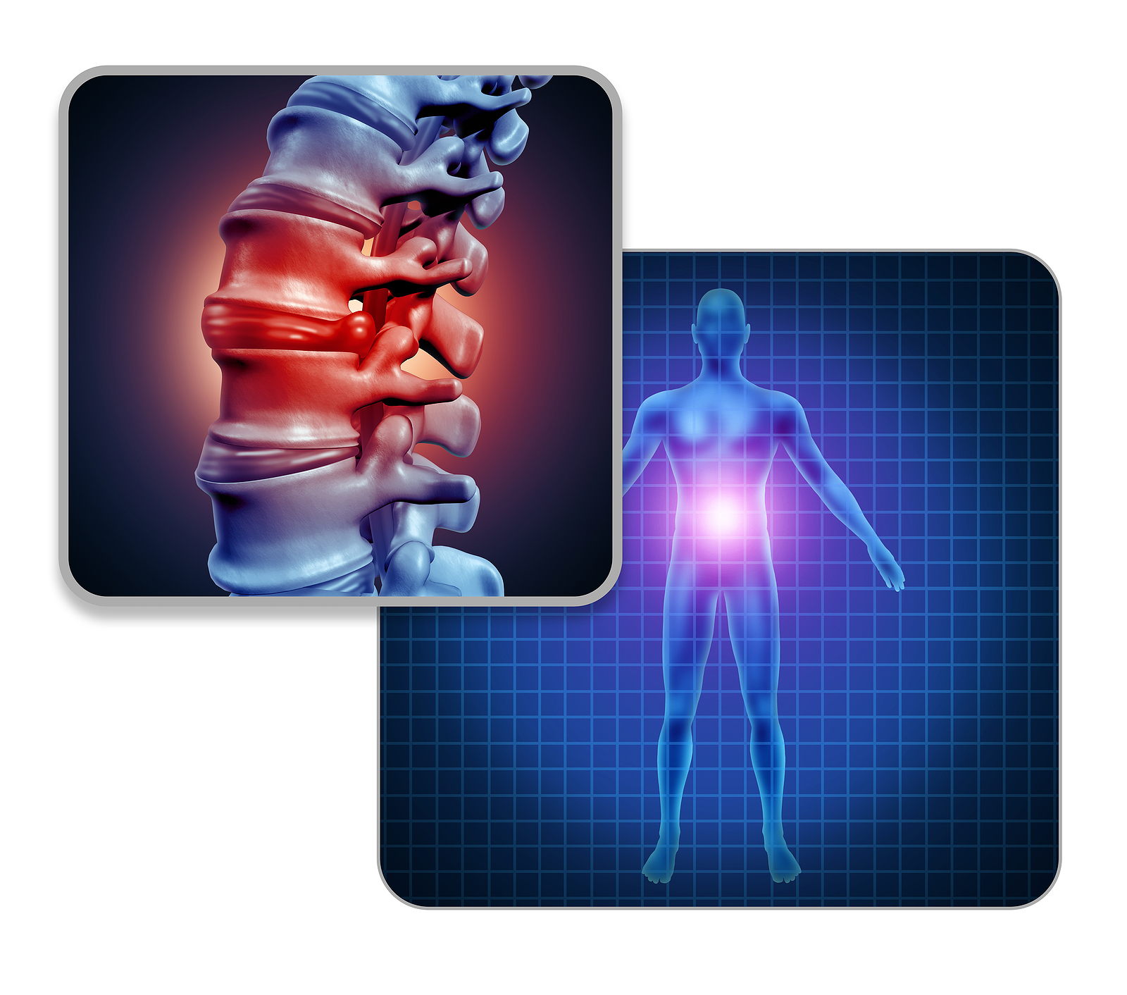 Preexisting Asymptomatic Conditions in Personal Injury Cases